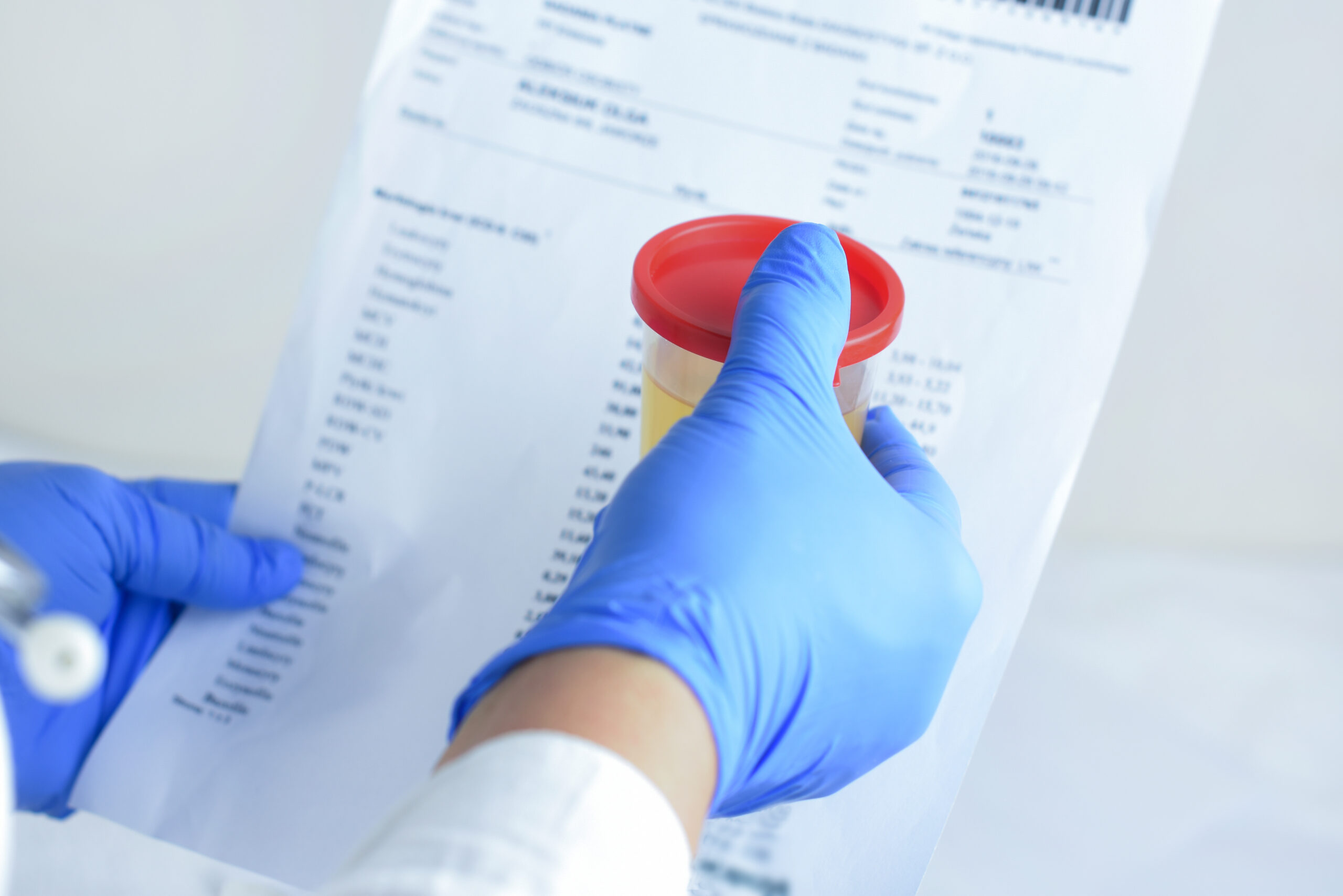When Should You Drug Test Your Employees?